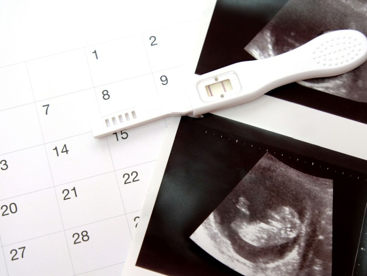 Legalnej aborcji w Polsce już prawie nie ma. A ile ciąż usuwa się naprawdę? Legalnej aborcji w Polsce już prawie nie ma. A ile ciąż usuwa się naprawdę?