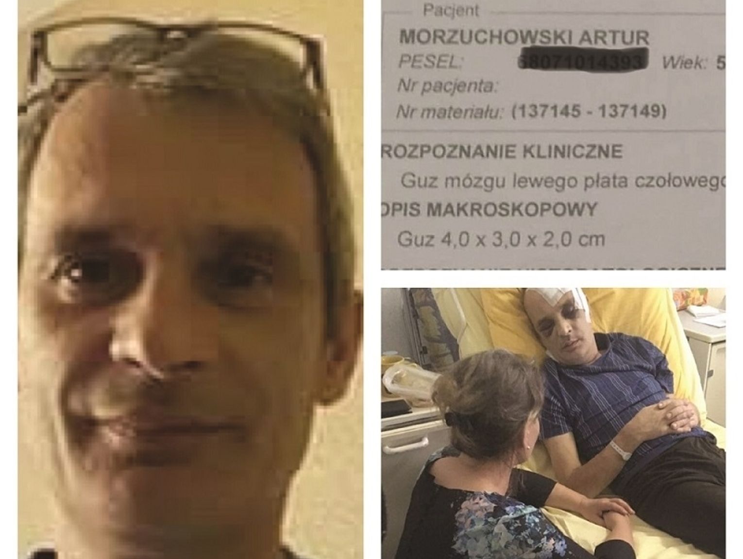 Zrzutka na leczenie guza mózgu | Super Tydzień